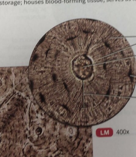 Bone slide Flashcards | Memorang