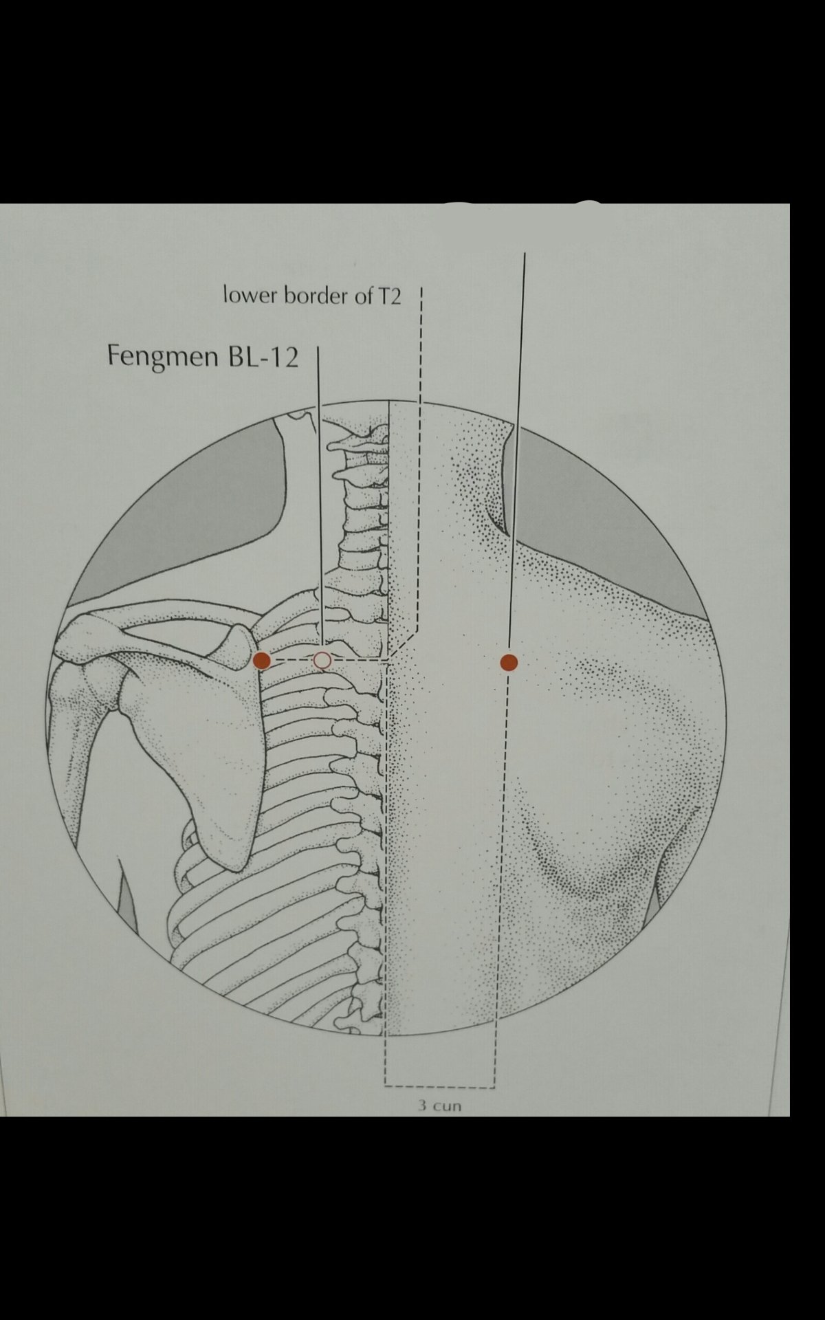 Bladder Channel 3 Flashcards | Memorang