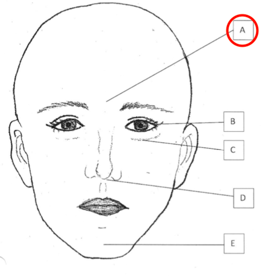 Facial Landmarks and Lines Flashcards | Memorang