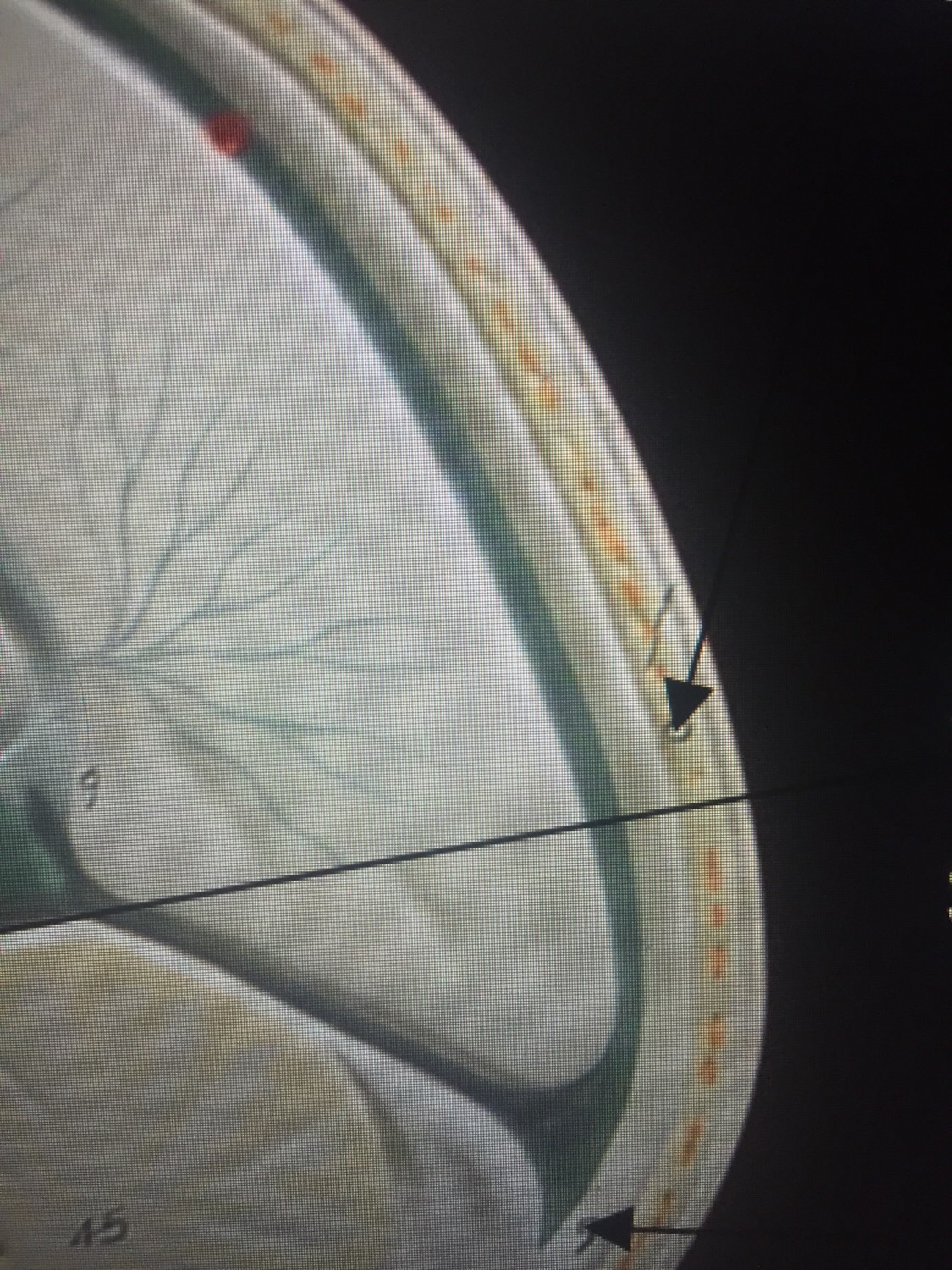 Lab final practical Flashcards | Memorang