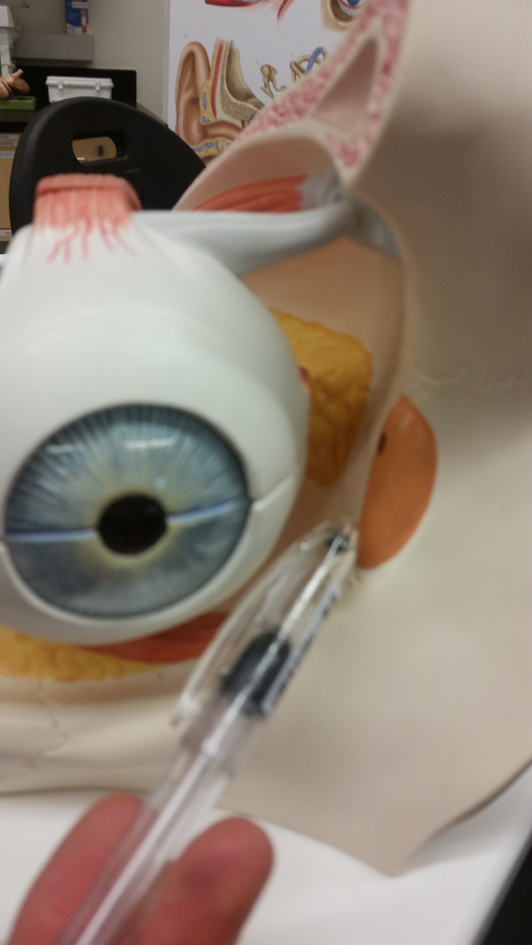 Eye Models Flashcards | Memorang