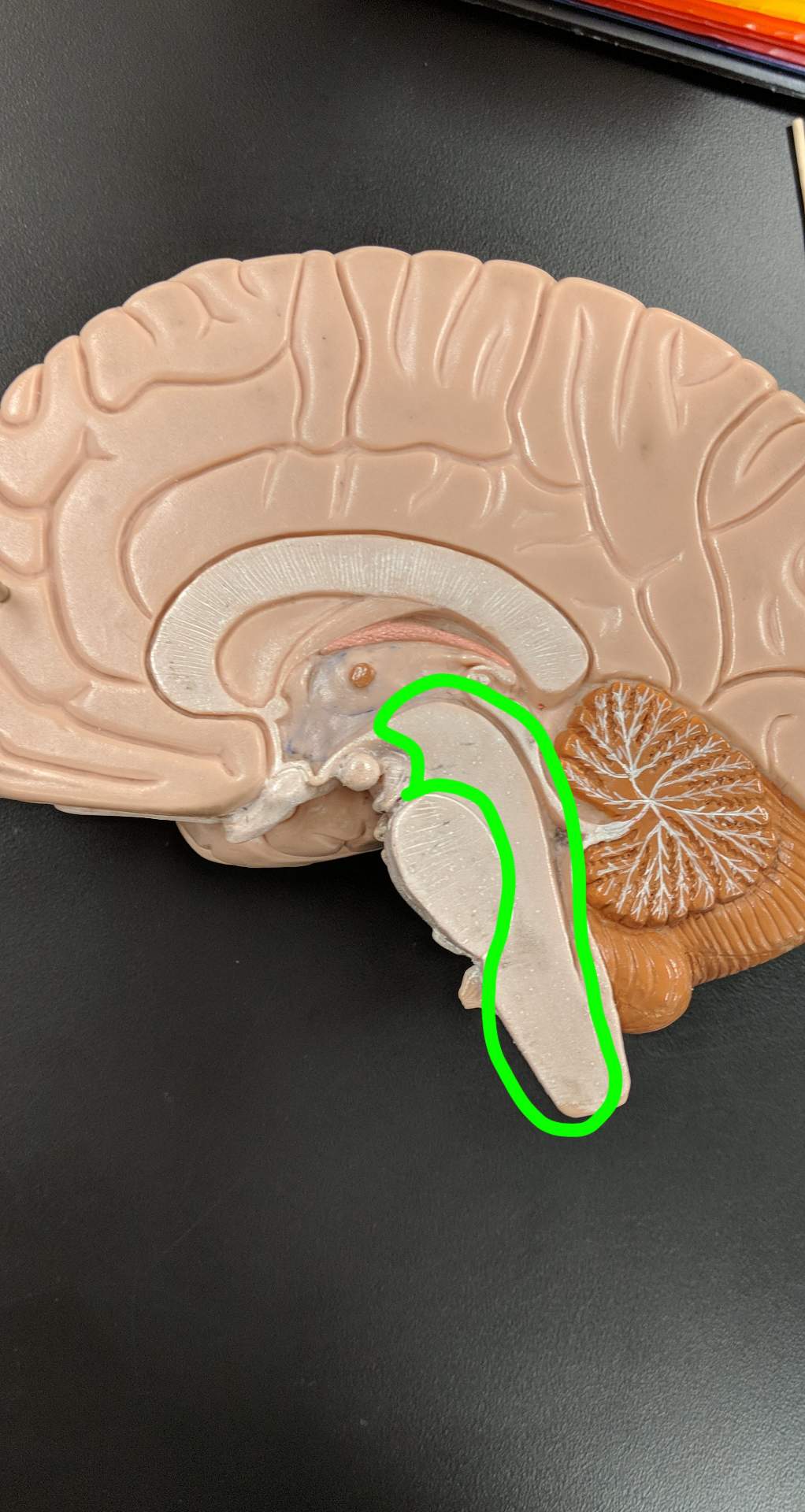 Brain Flashcards | Memorang