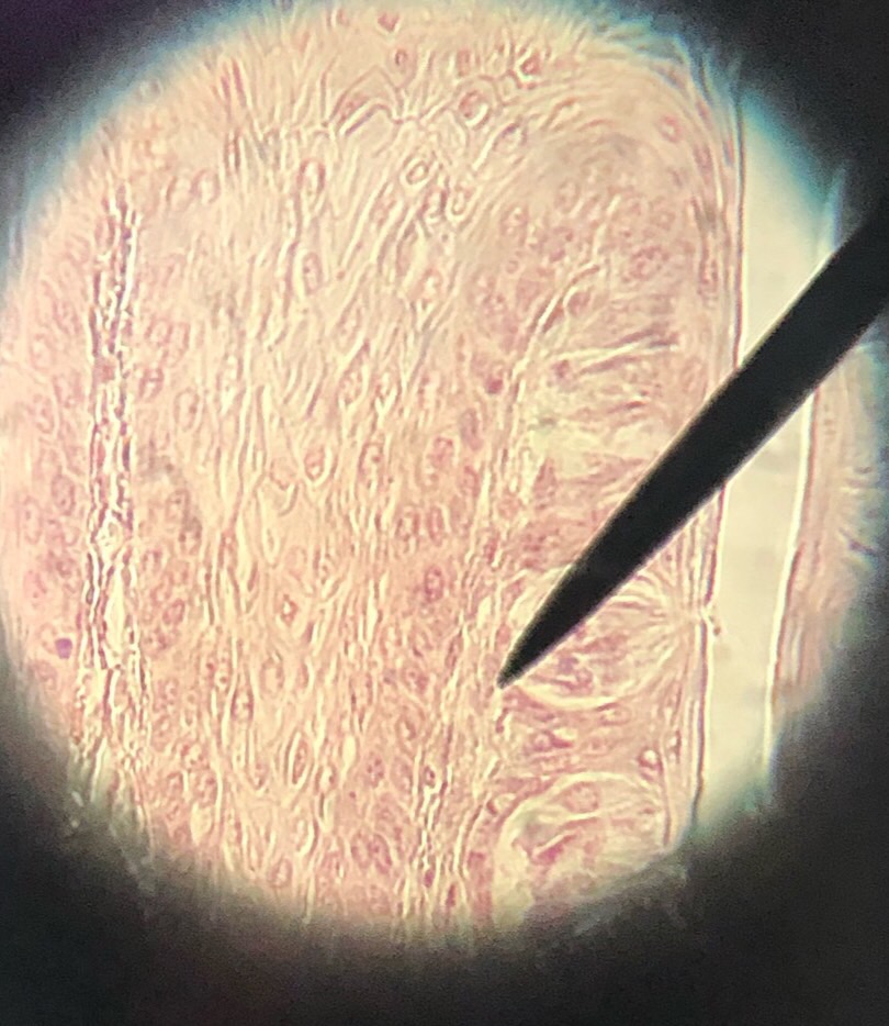 Practical 2 Flashcards | Memorang