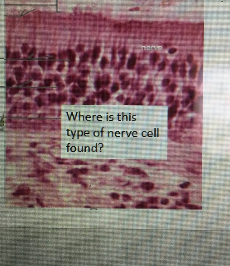 Histology of neuro Flashcards | Memorang