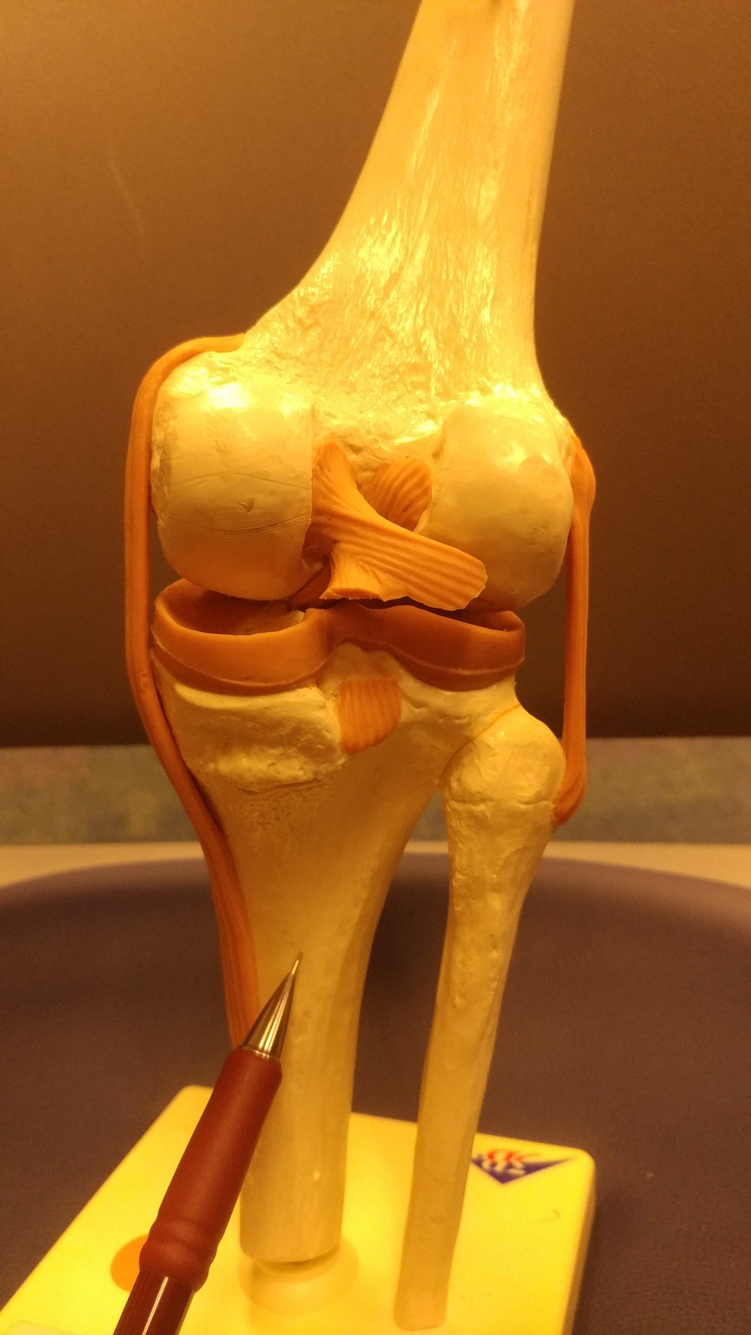 The knee joint model Flashcards | Memorang