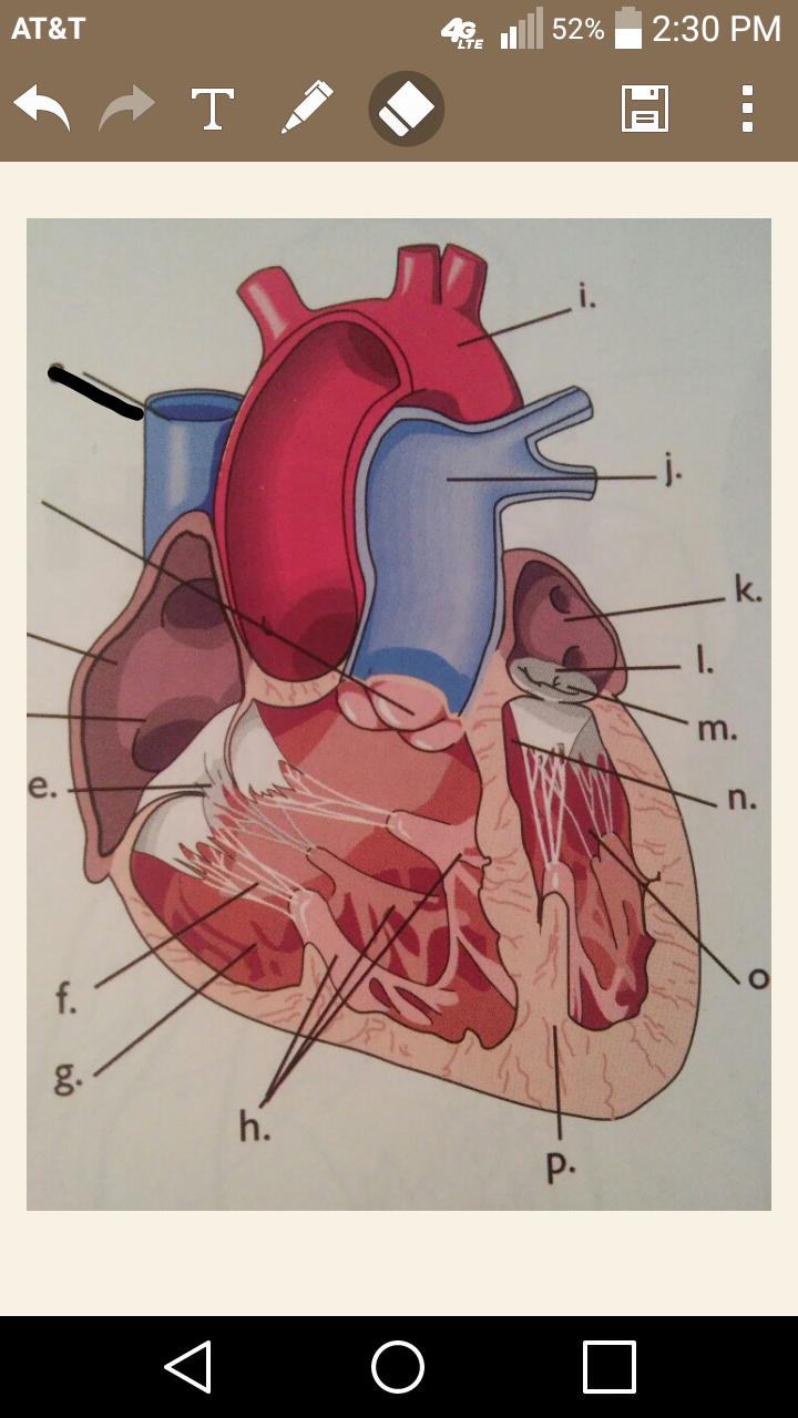 Heart Anatomy (1) Flashcards | Memorang