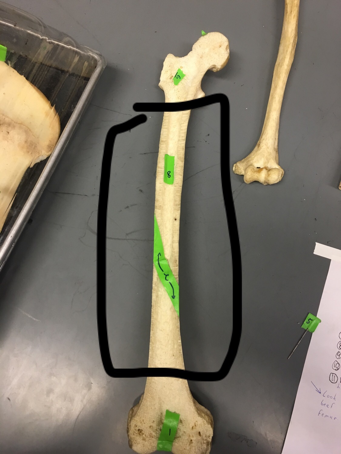 Bone and joint anatomy Flashcards | Memorang