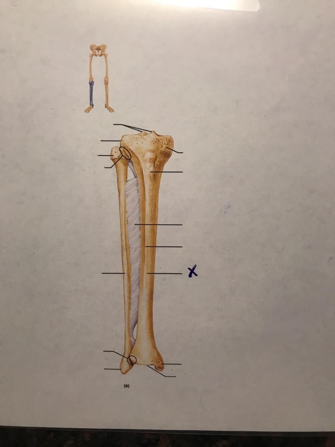 Lower leg tibia and fibula Flashcards | Memorang