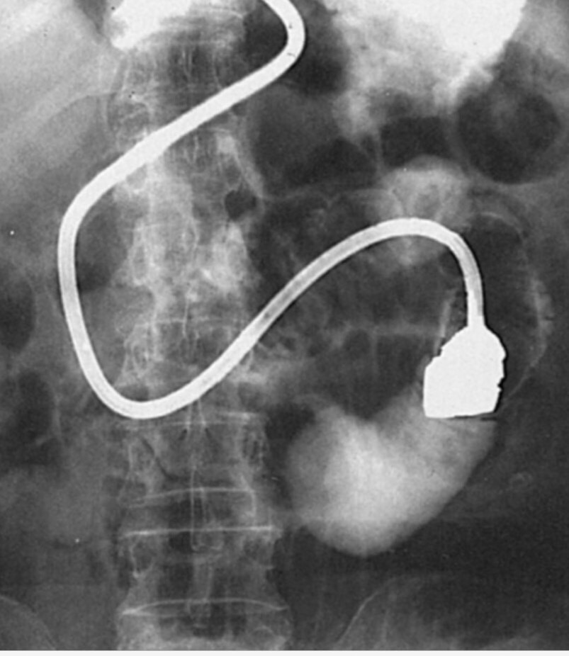 Tubes and Lines Flashcards | Memorang