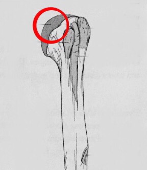 Anatomy: Bony Landmarks of the Arm Bones Flashcards | Memorang