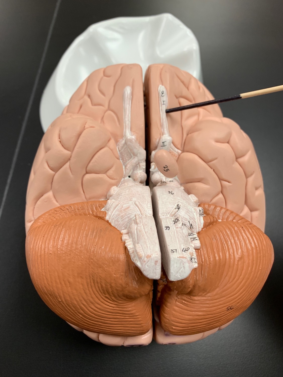 Cranial Nerves Flashcards | Memorang