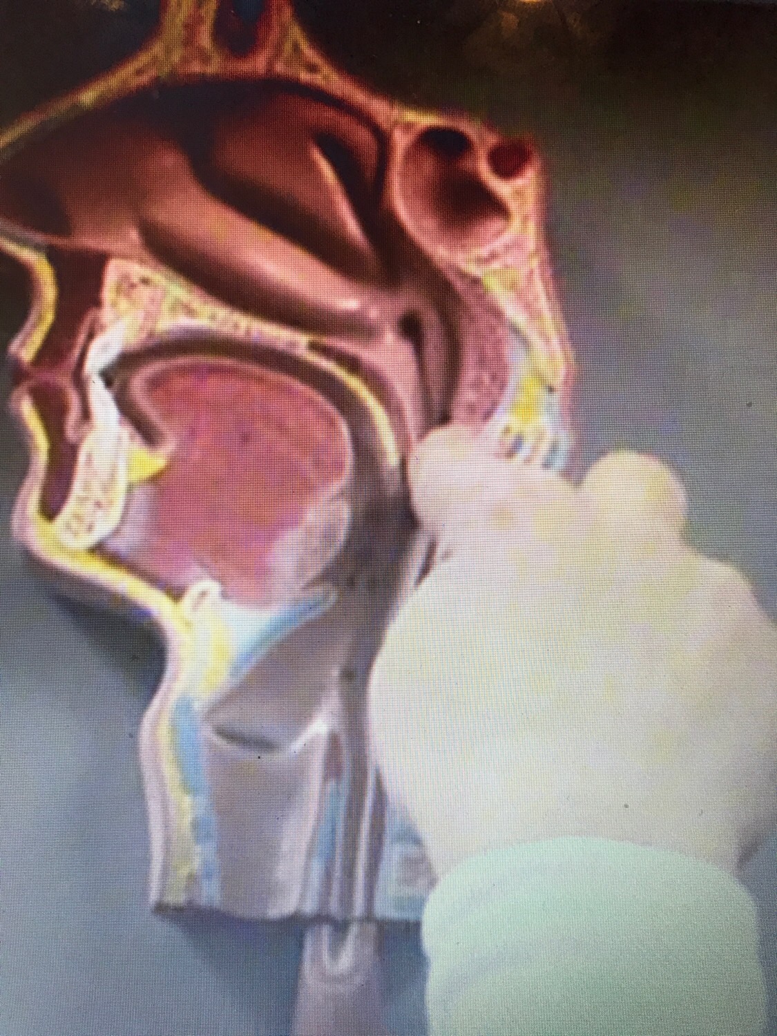 Digestive models Flashcards | Memorang