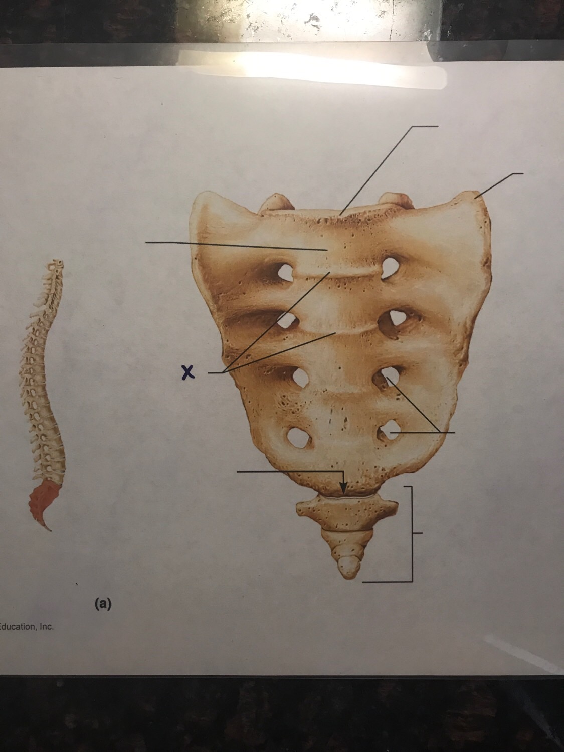Sacrum Flashcards | Memorang
