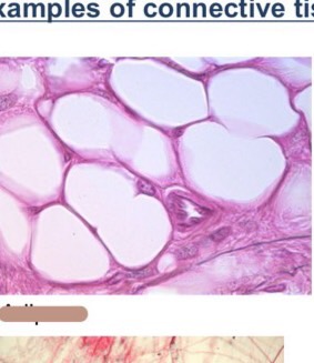 Connective tissue lab Flashcards | Memorang