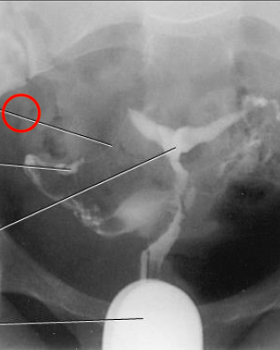 Fluoroscopy Flashcards | Memorang