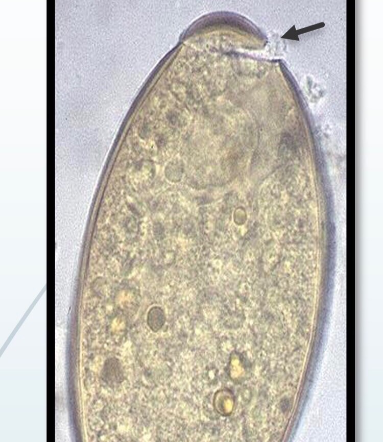 Pasta Flashcards | Memorang