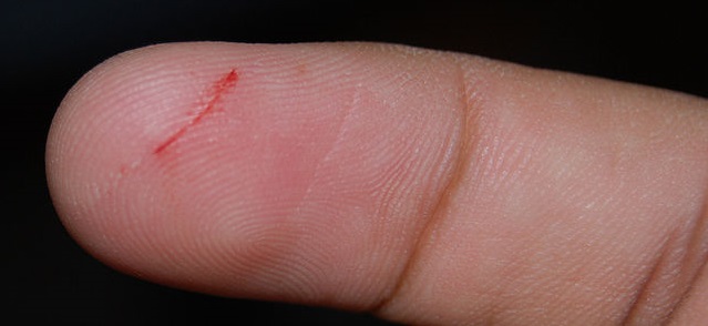 Hazards Flashcards Memorang