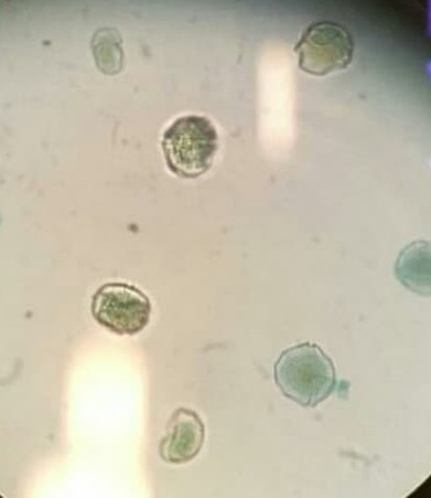 Plankton ID Flashcards | Memorang