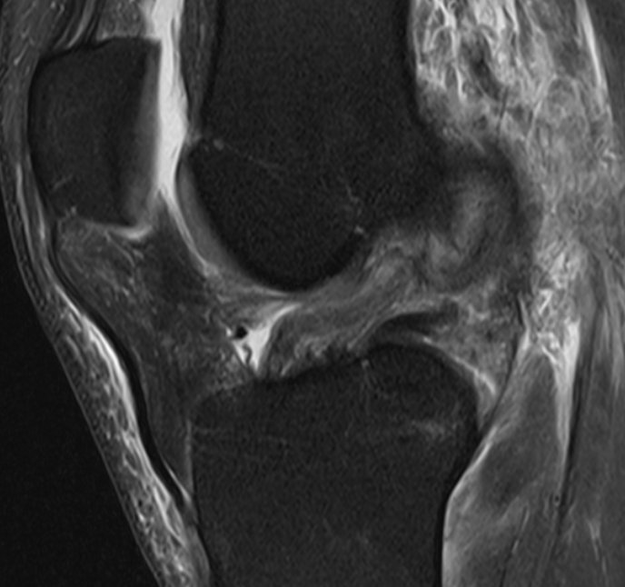 Skeletal Radiology Flashcards | Memorang