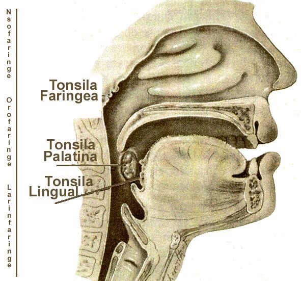 Faringotonsilites Flashcards | Memorang