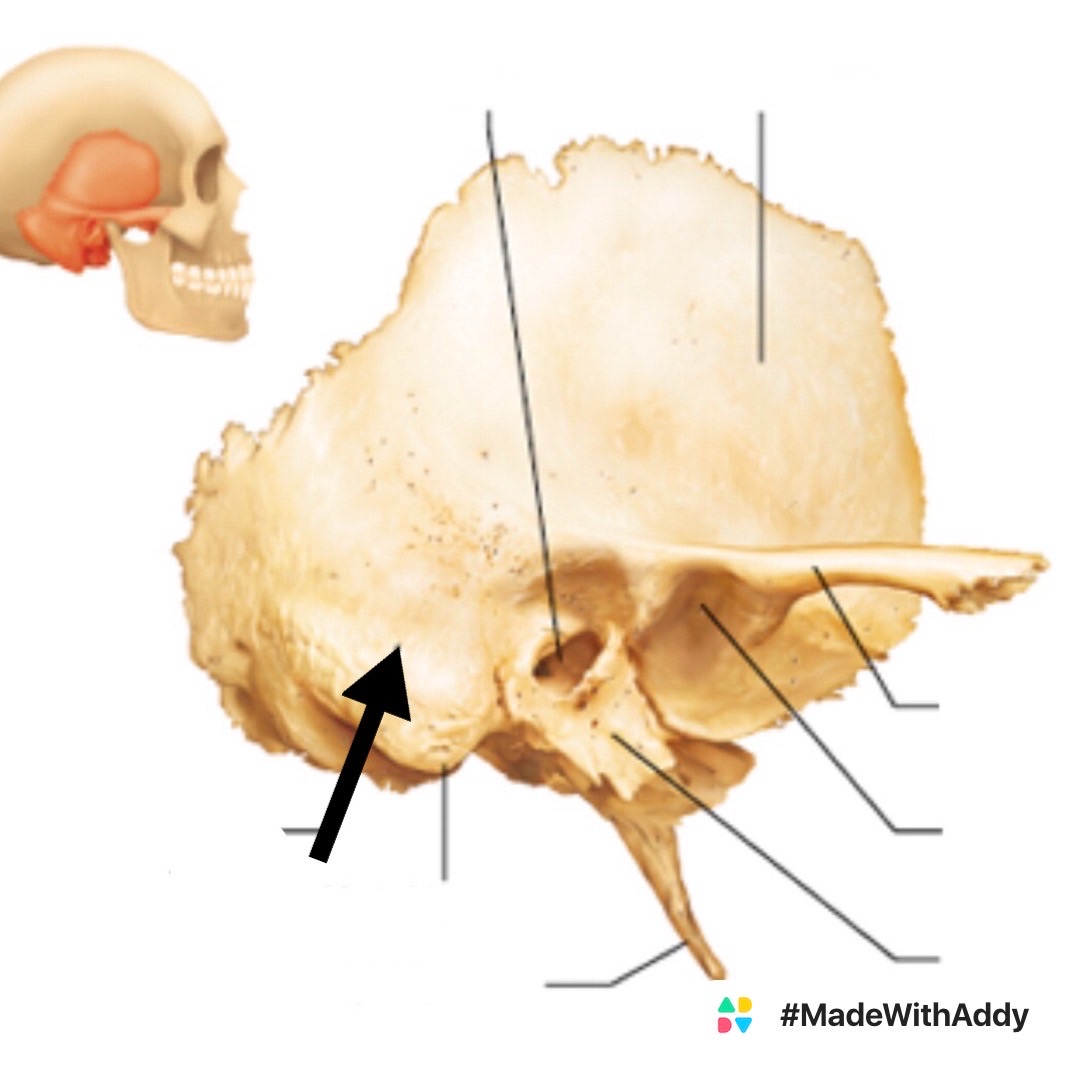 Temporal, Sphenoid, and Ethmoid bone (s) Flashcards | Memorang