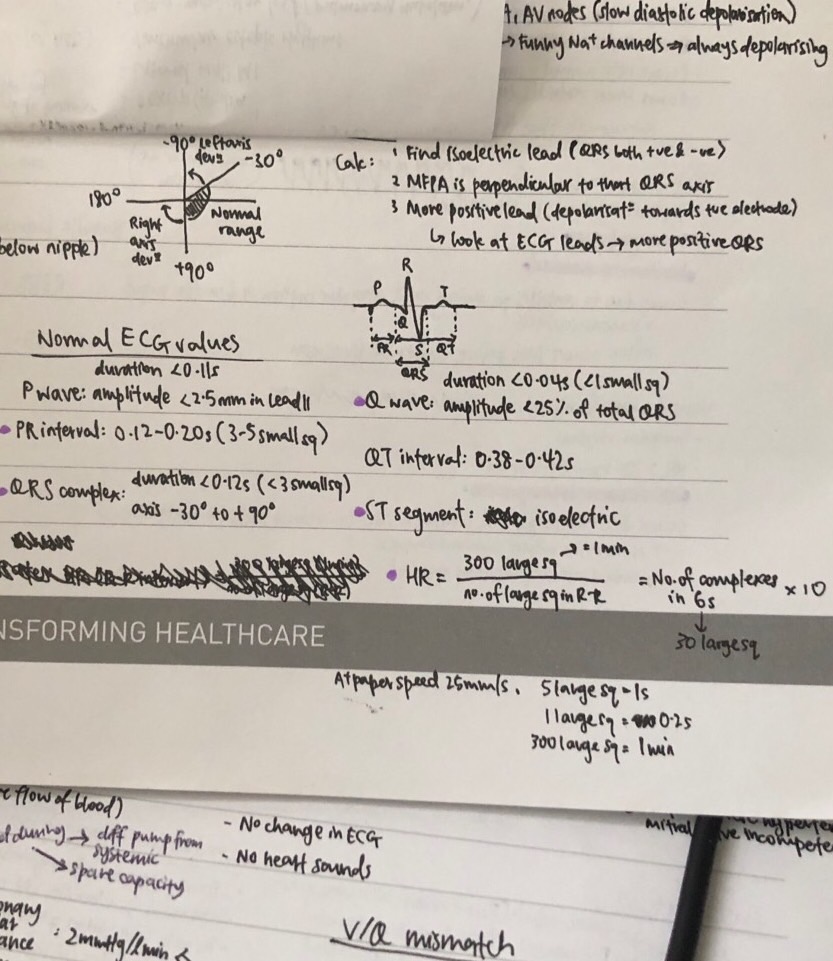 Common Cardiac Arrhythmias Flashcards Memorang