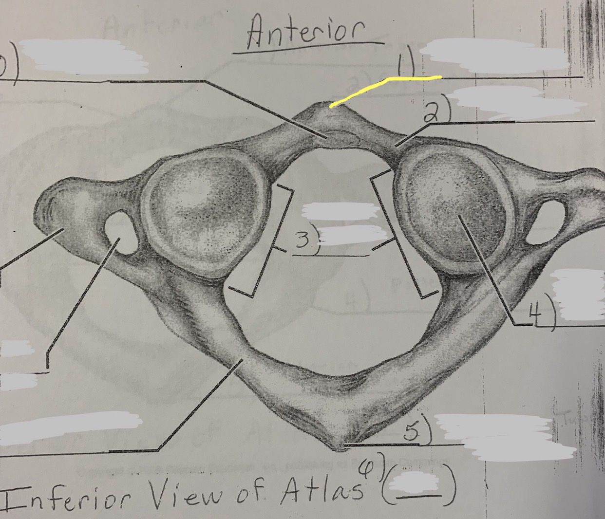 Inferior View of Atlas Flashcards | Memorang