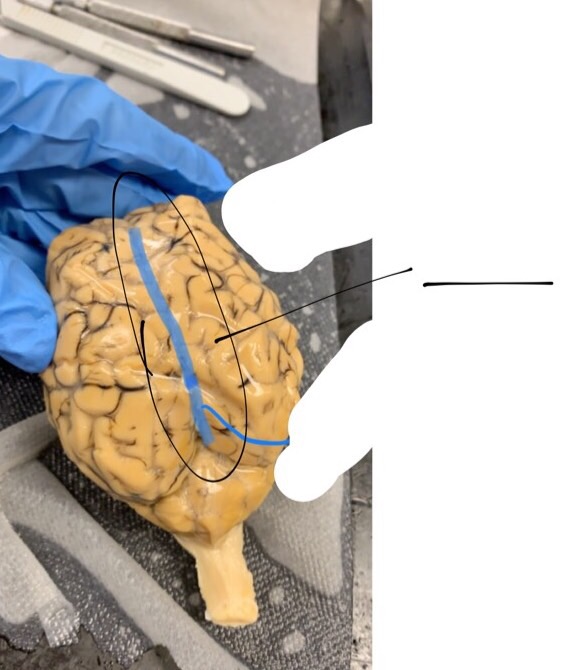 Brain Flashcards | Memorang