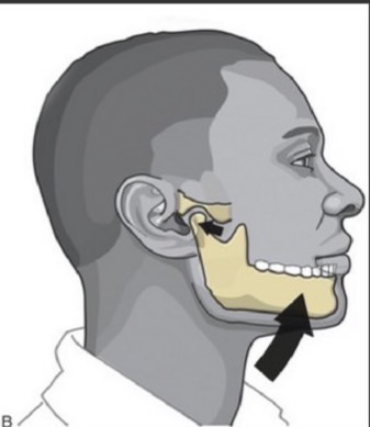 Types of body movements Flashcards | Memorang