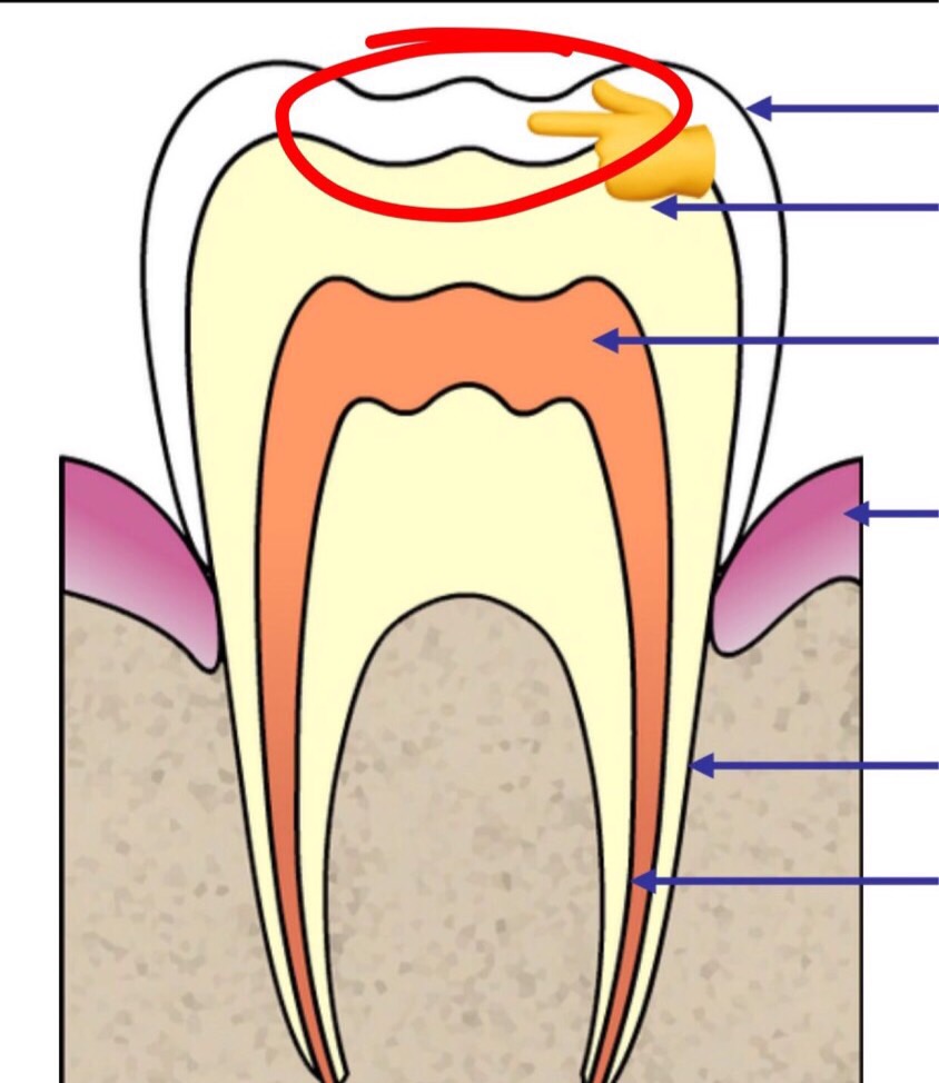 Tooth Section Flashcards | Memorang