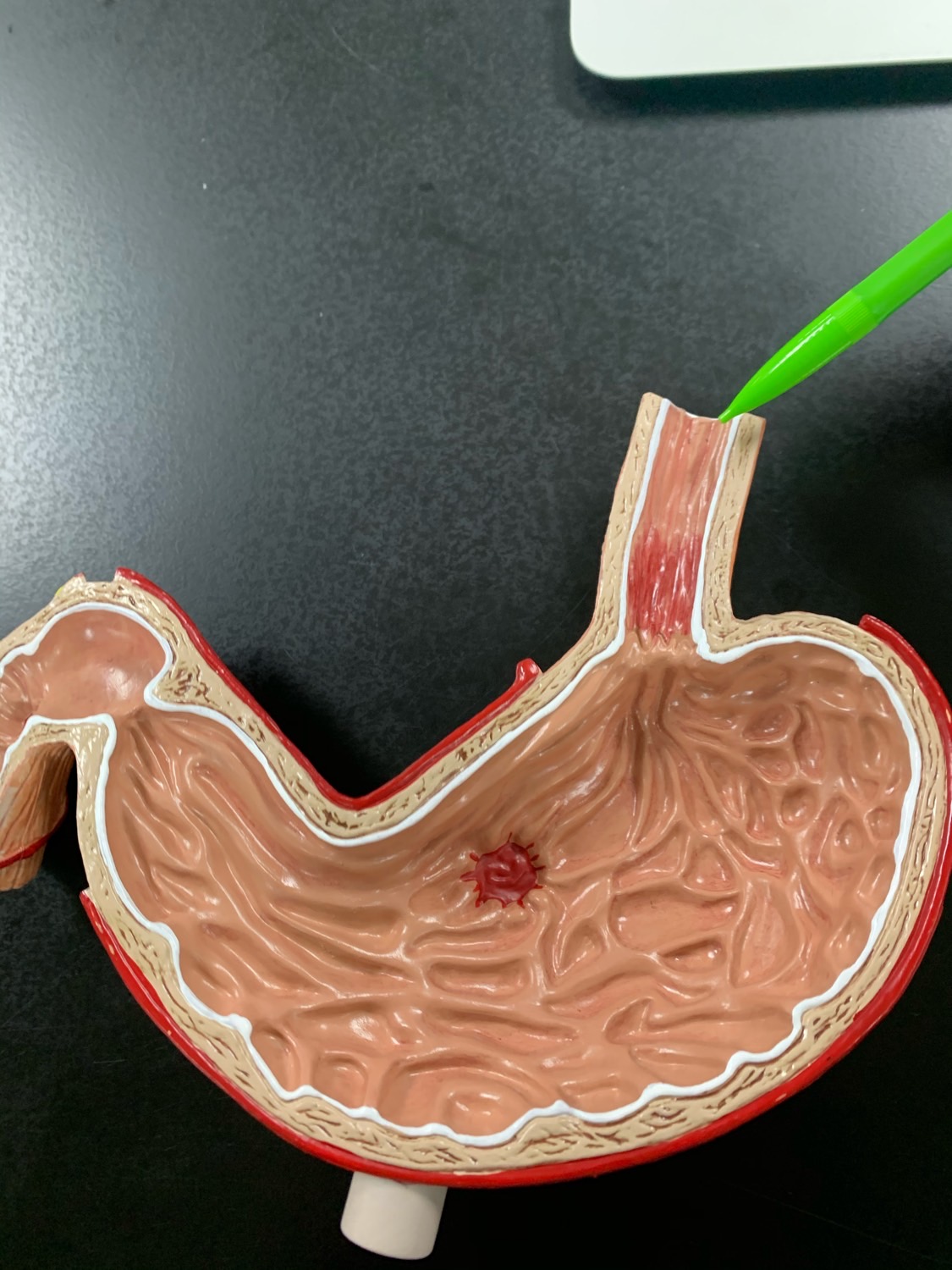 3D stomach model Flashcards | Memorang