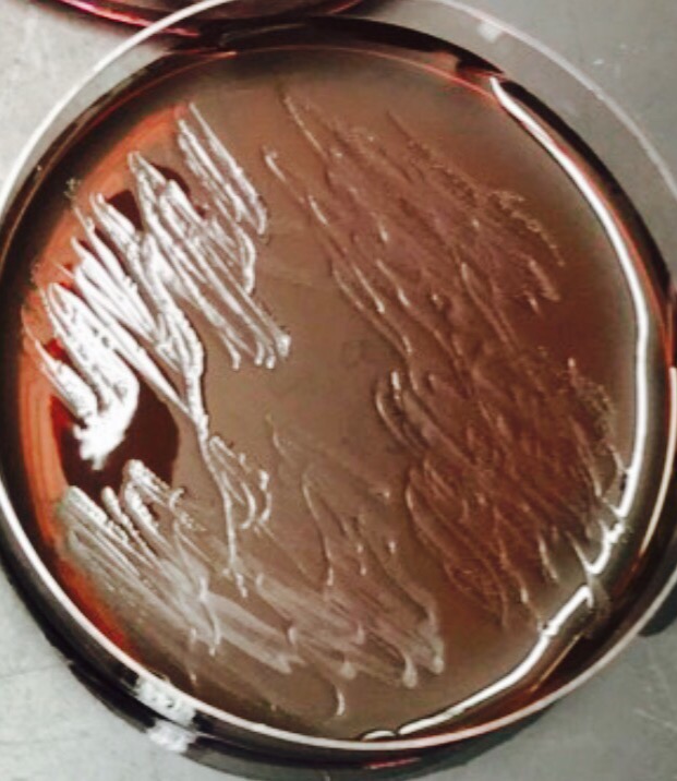 Differential Stains Flashcards | Memorang