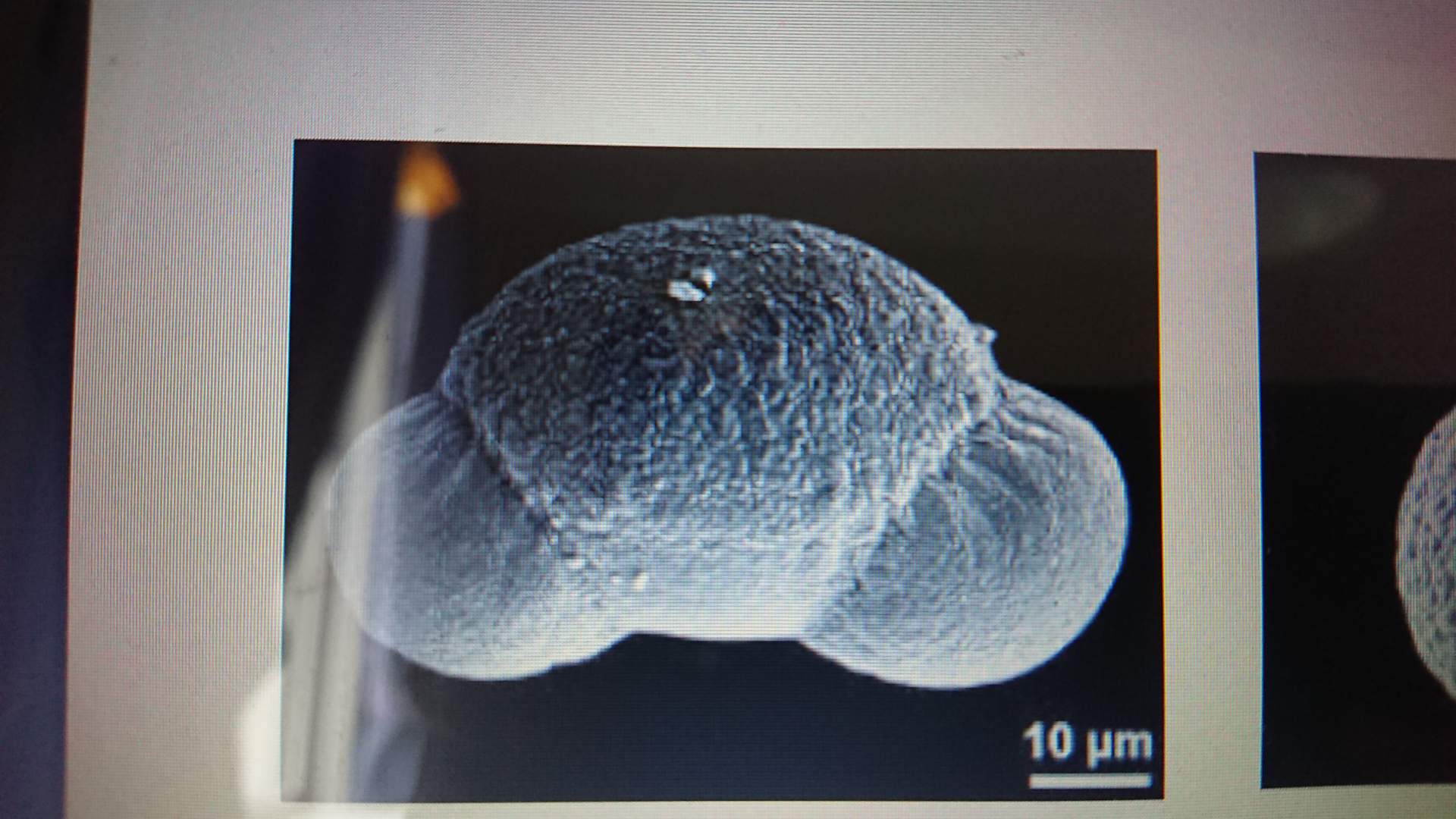 Pollen Flashcards | Memorang