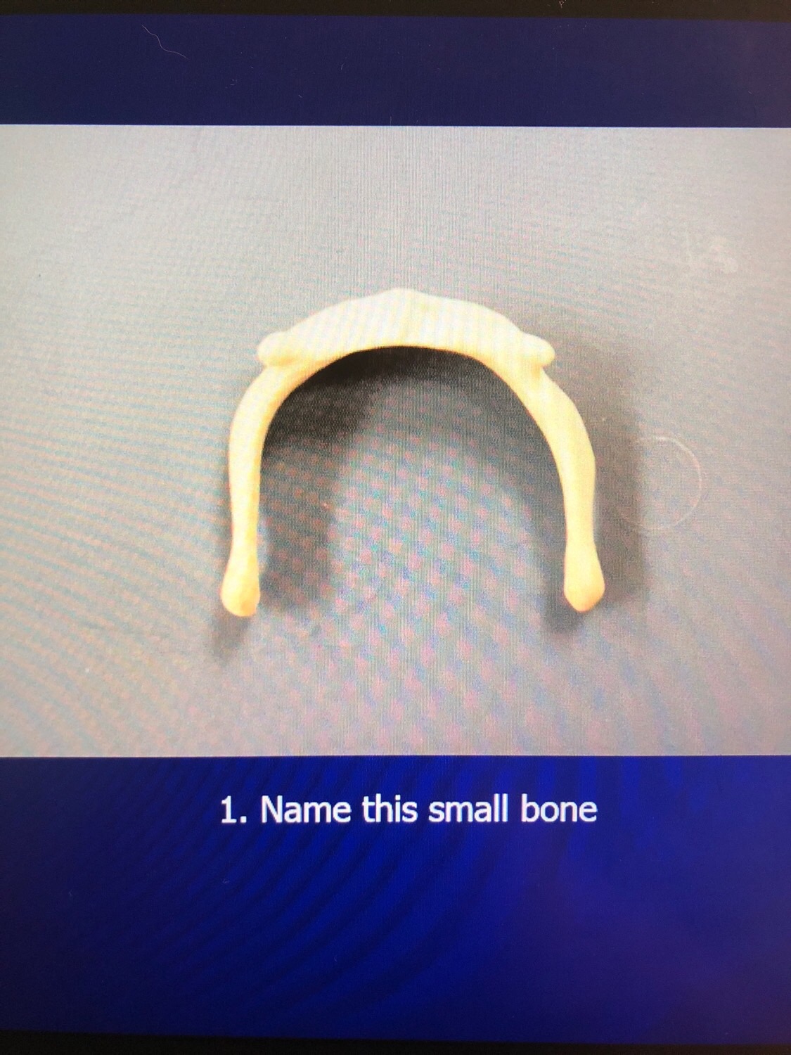 Post-Cranial Skeleton Flashcards | Memorang