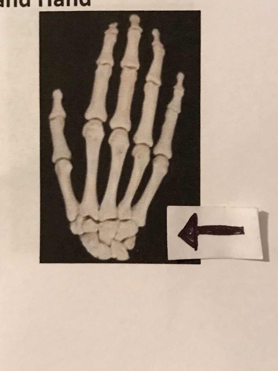 Anatomy And Physiology Flashcards Memorang