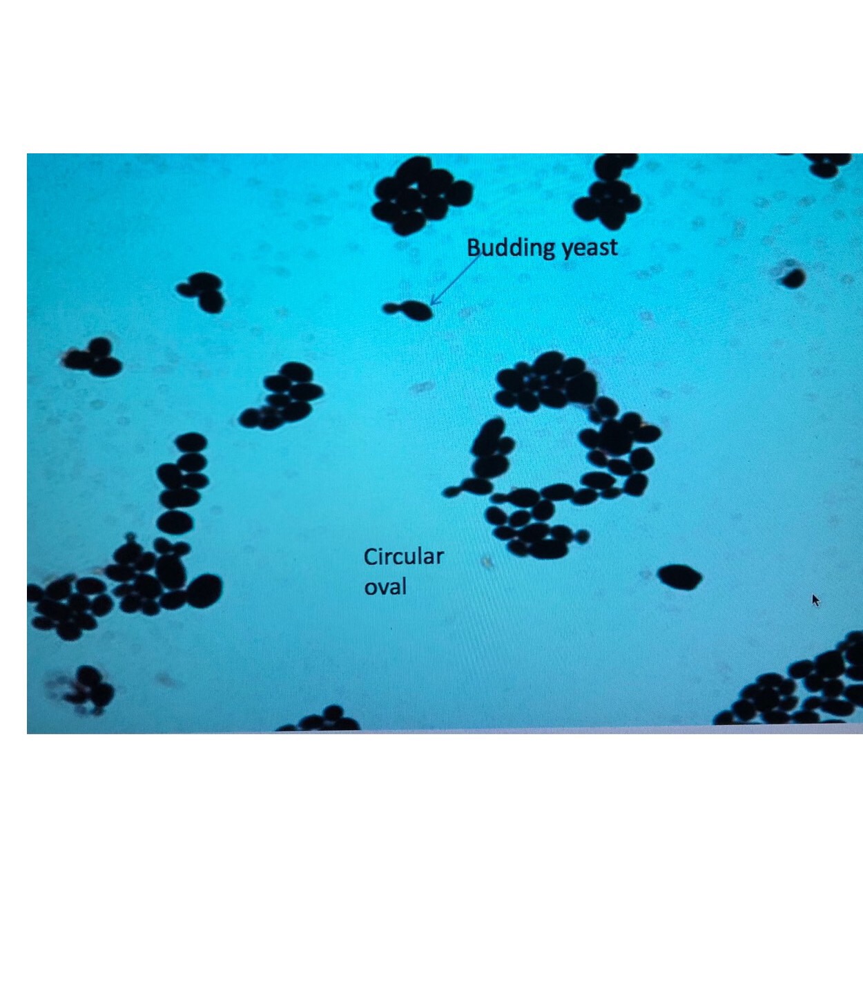 Yeasts & Molds Flashcards | Memorang