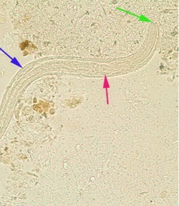 Intestinal helminths Flashcards | Memorang