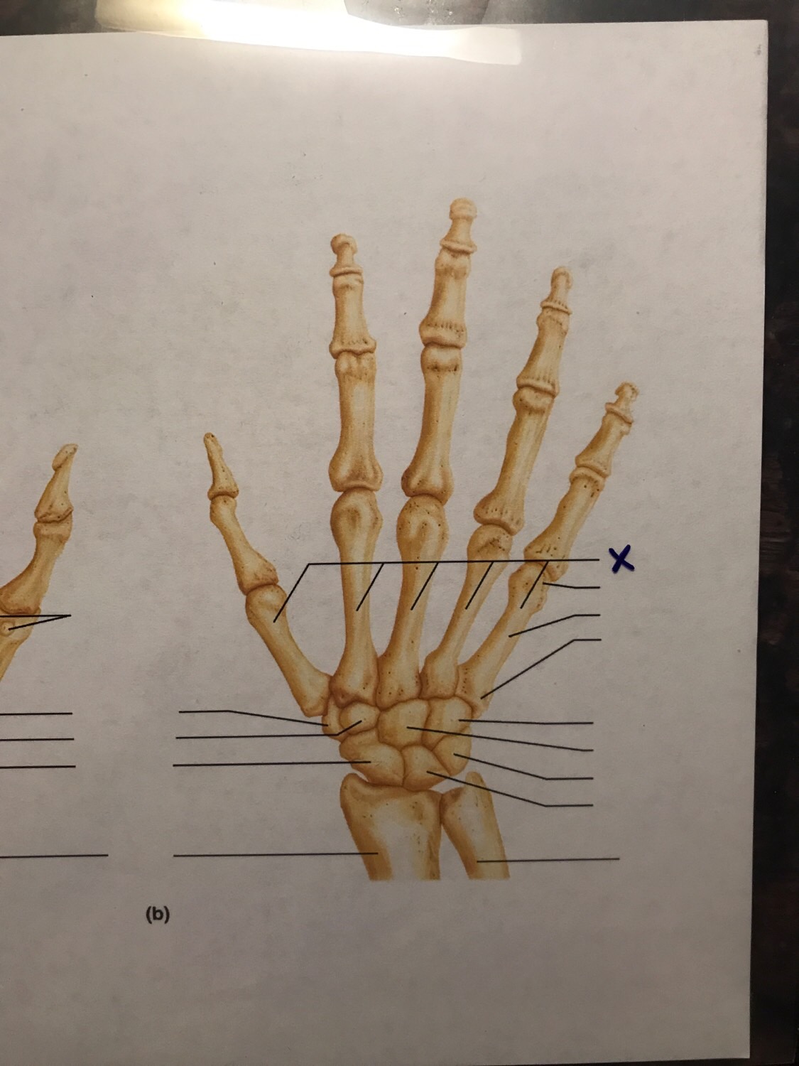 Hand metacarpals, hand, phalanges, sesamoid bones Flashcards | Memorang