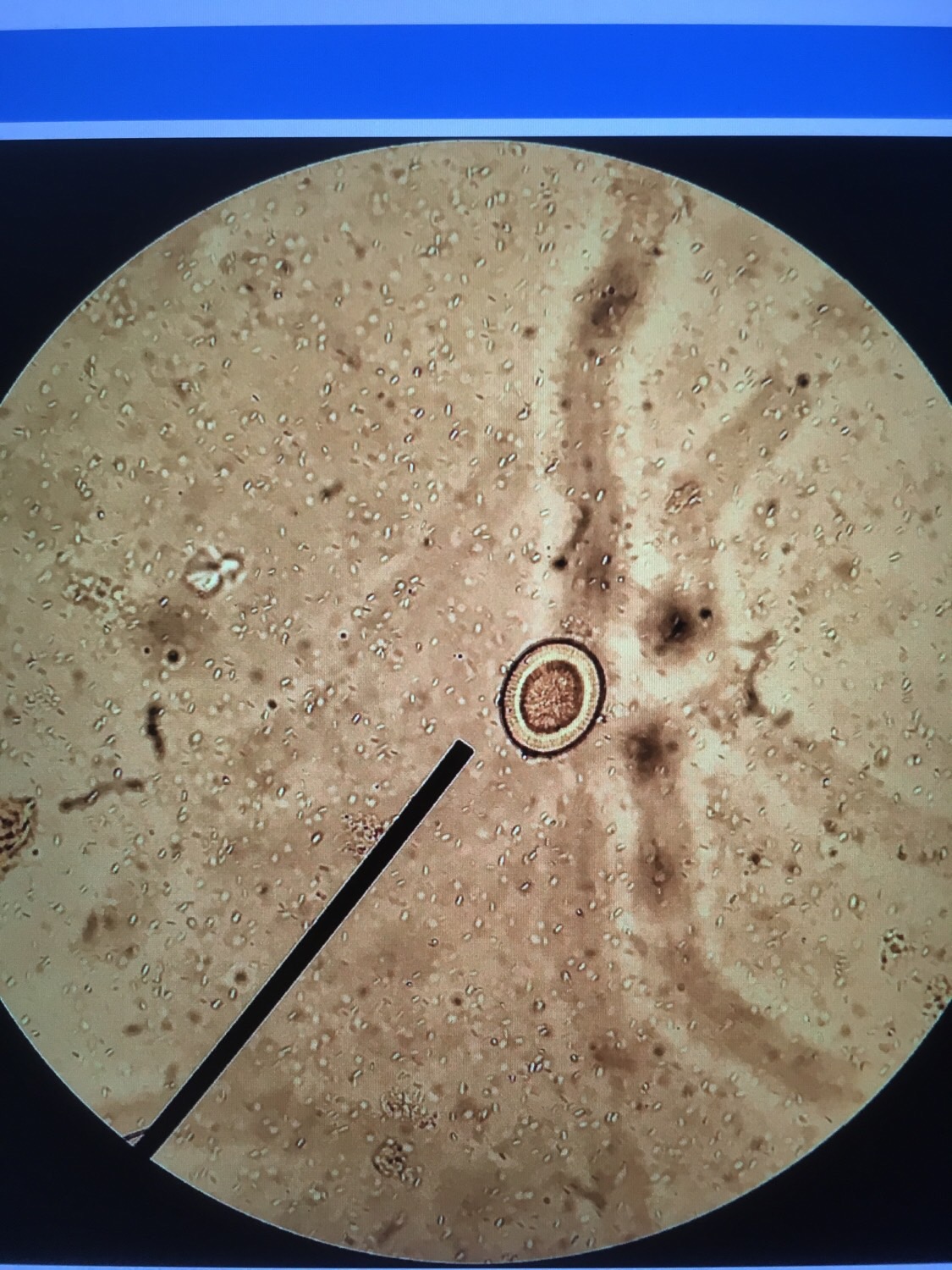 CESTODES Flashcards | Memorang