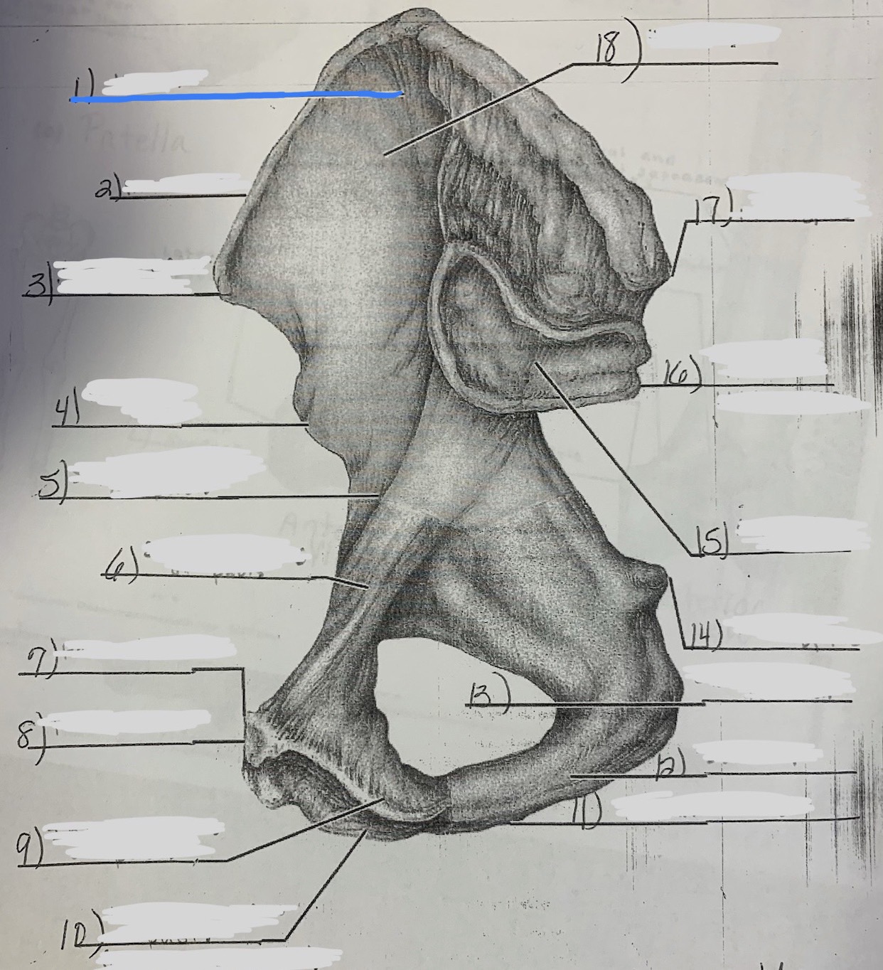 Right Hip Bone, Medial View Flashcards | Memorang