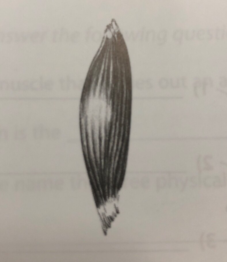 Types of Muscle Bellies and Joints Flashcards | Memorang