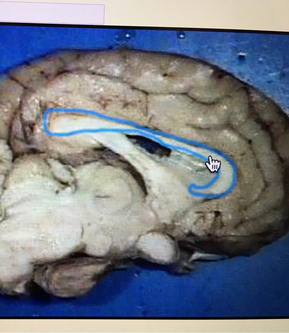 Sheeps brain dissection Flashcards | Memorang