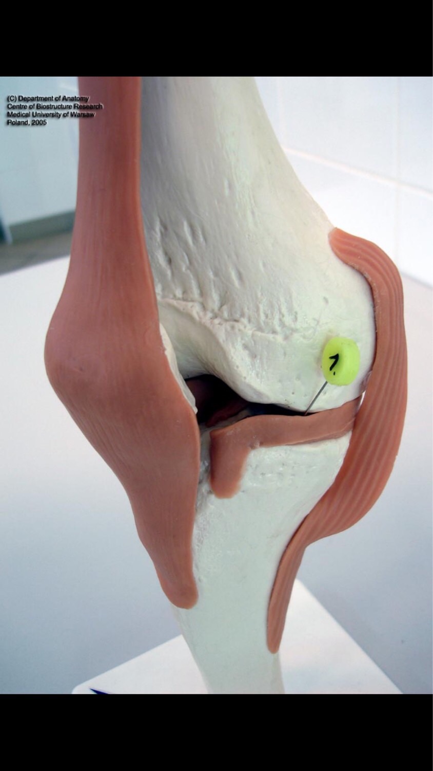 Random pins Flashcards | Memorang