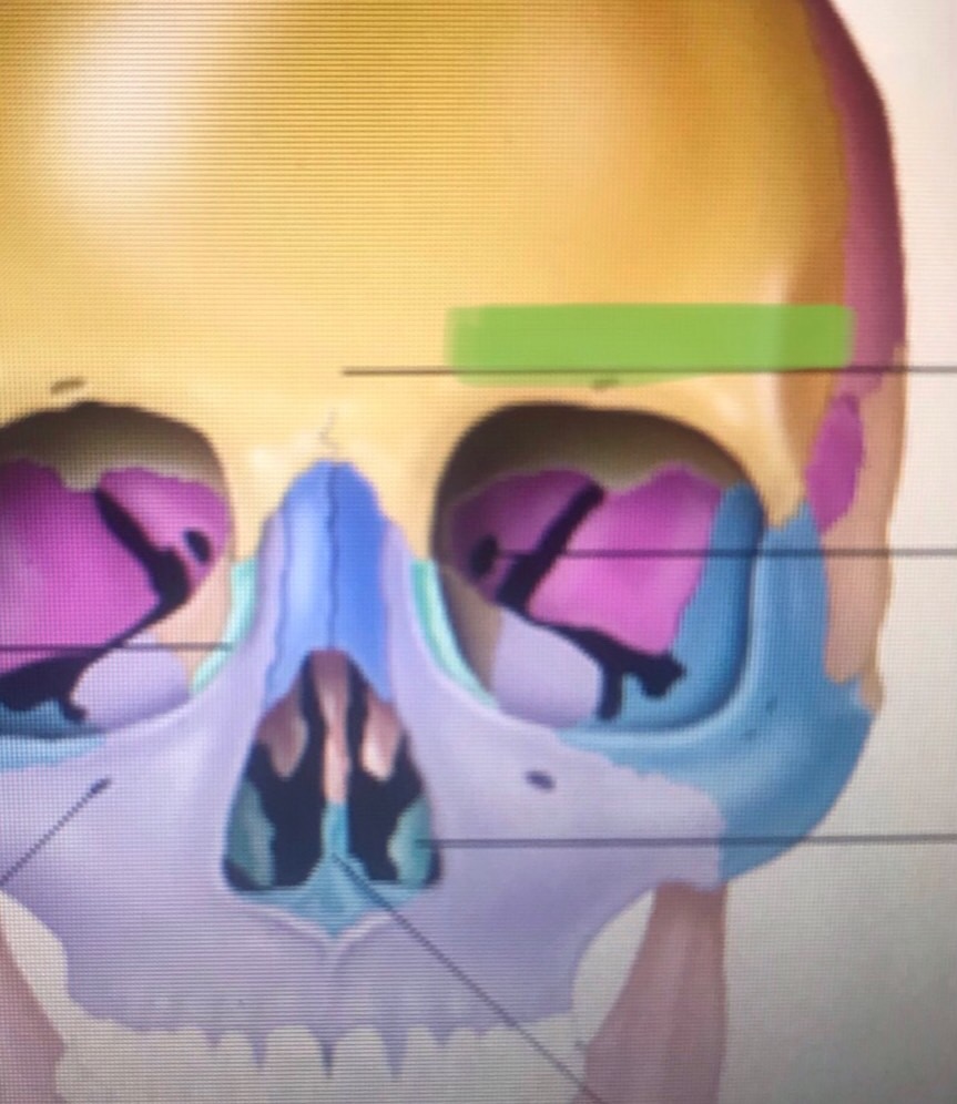 Facial Bones Flashcards Memorang Facial Bones Flashcards Memorang