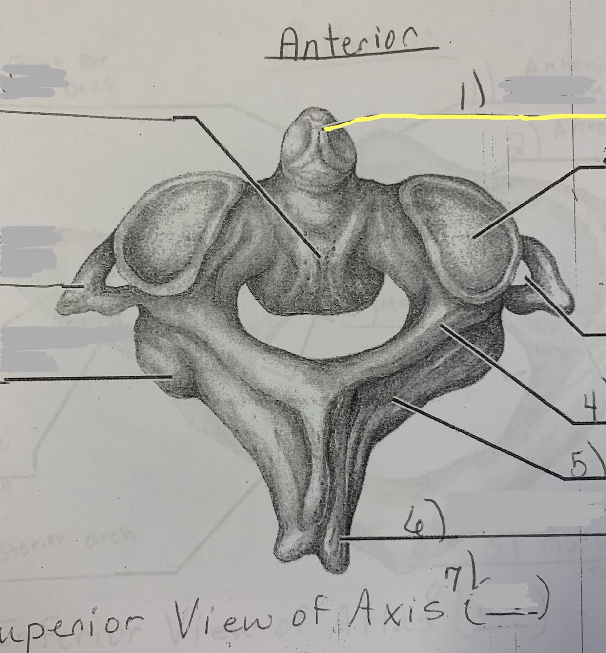 Superior View of Axis Flashcards | Memorang