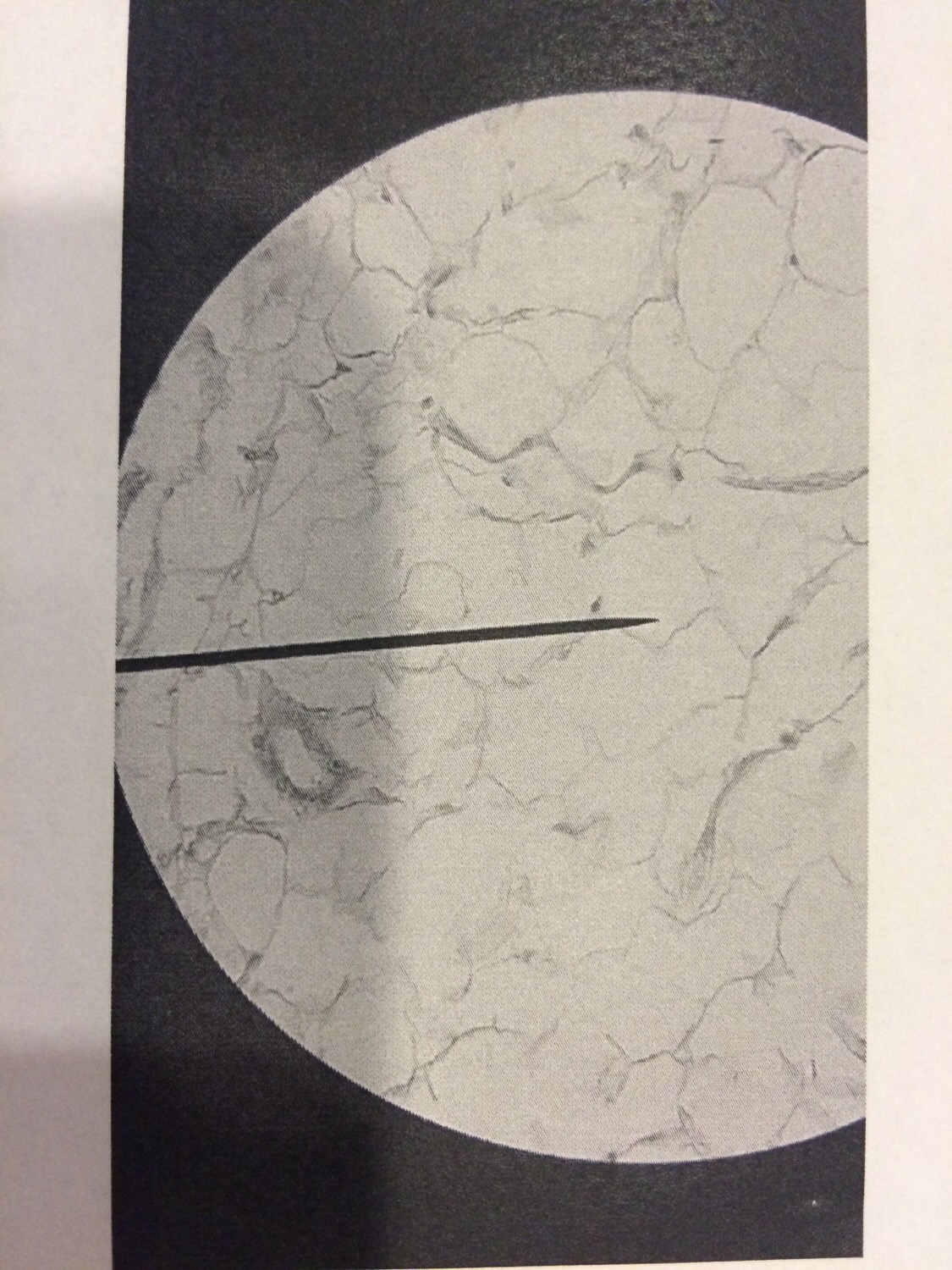 practical 2 Flashcards | Memorang