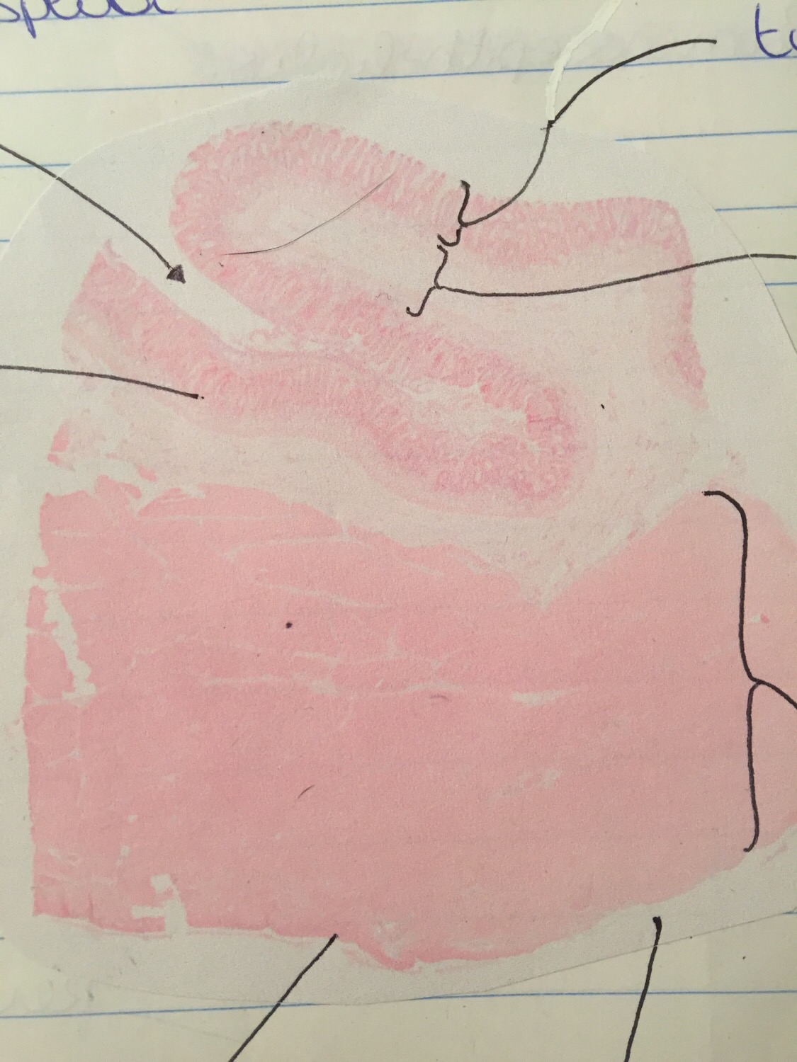 Epitheel Flashcards | Memorang