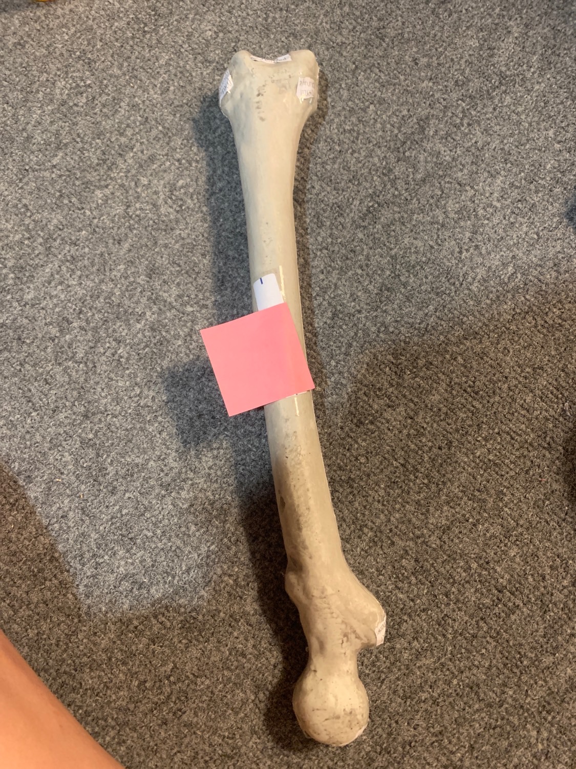 Bones pt. 2 Flashcards | Memorang