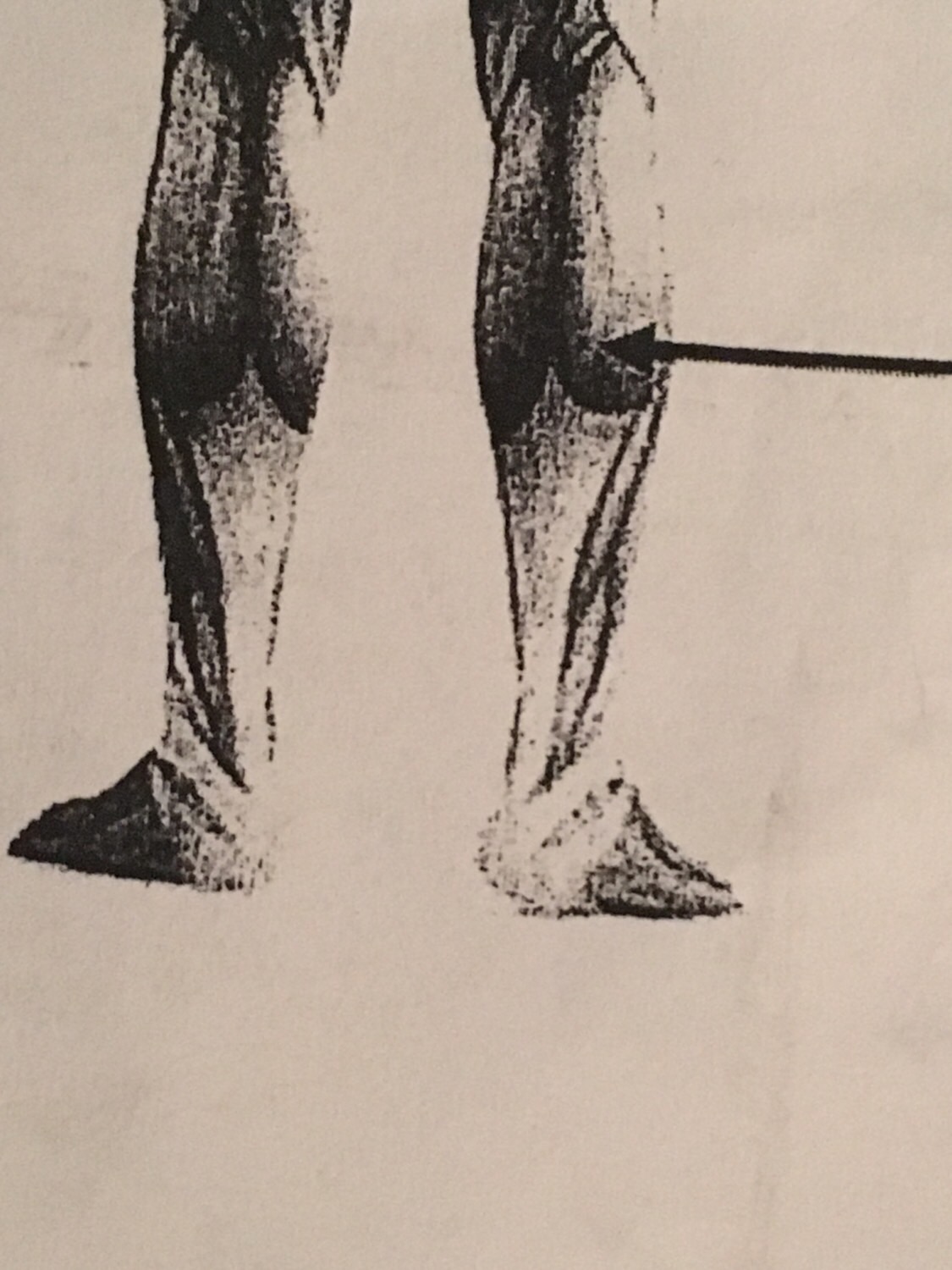 PE Muscle Anatomy Flashcards | Memorang