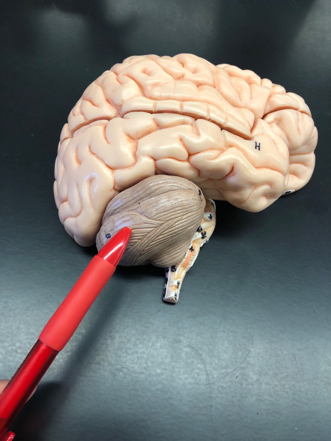 Brain Flashcards | Memorang